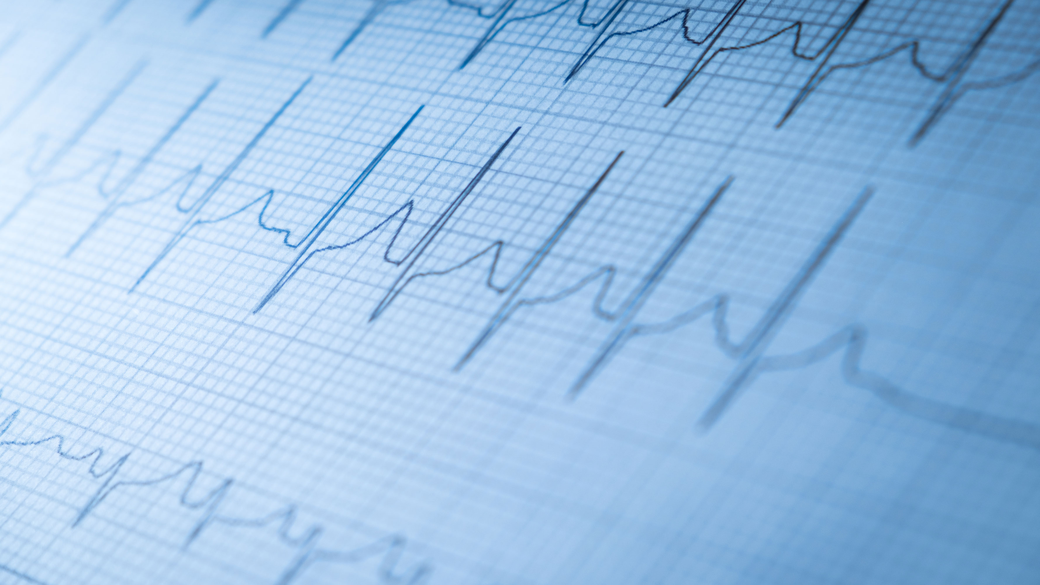 How Womens Heart Health Differs From Mens 9150